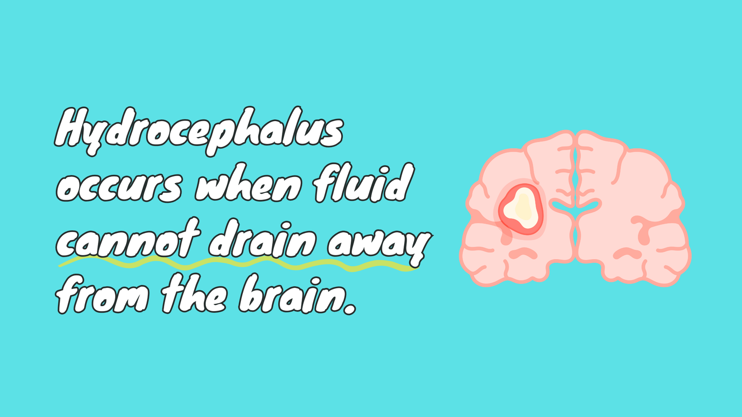 Your Quick Guide to Hydrocephalus • SHASBAH
